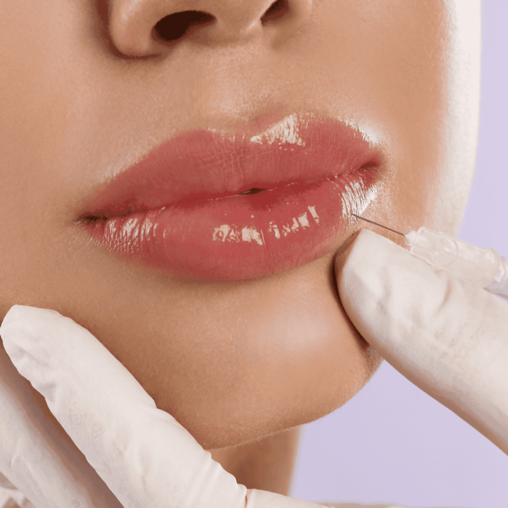 Lip Filler in Denville NJ | Full & Natural Lip Enhancement