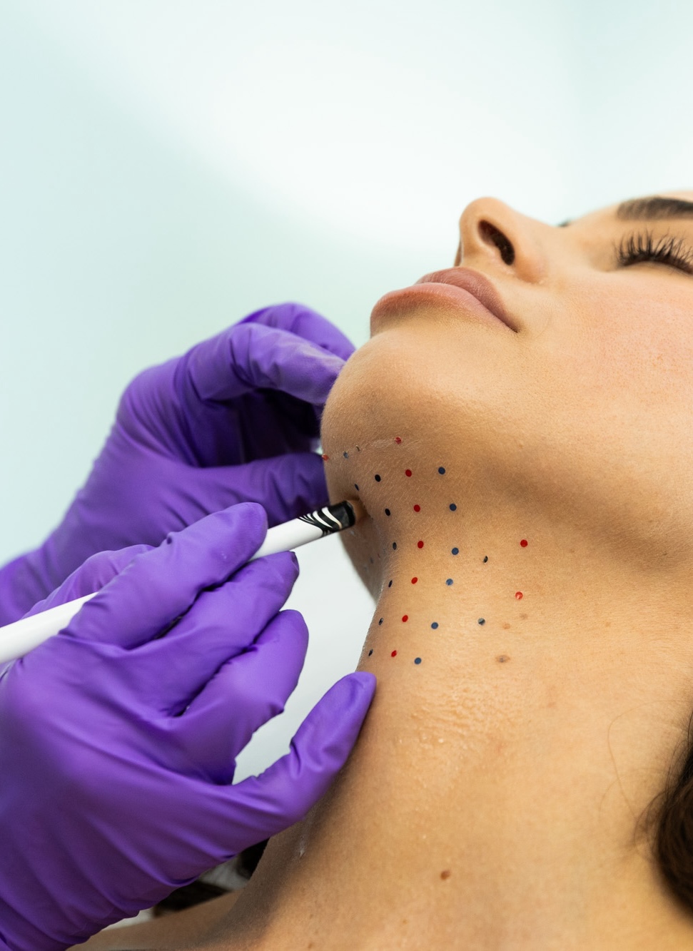 Neck Filler in Denville, NJ | Juvederm Injections