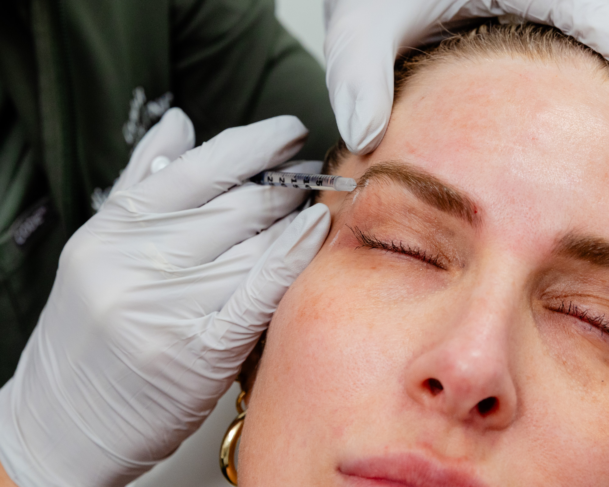 Botox in Denville | Exhibit Medical Aesthetics