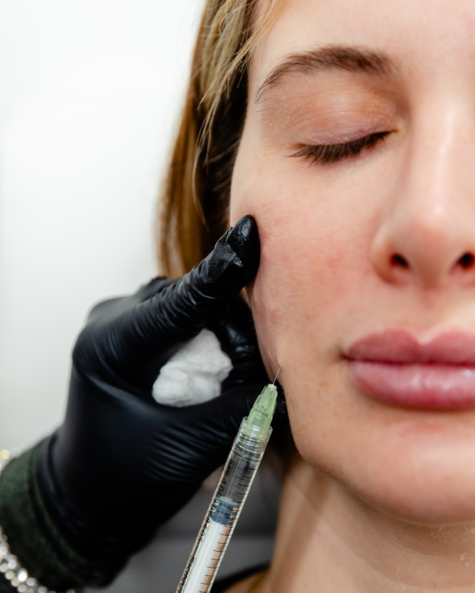 Skinvive in Denville | Exhibit Medical Aesthetics